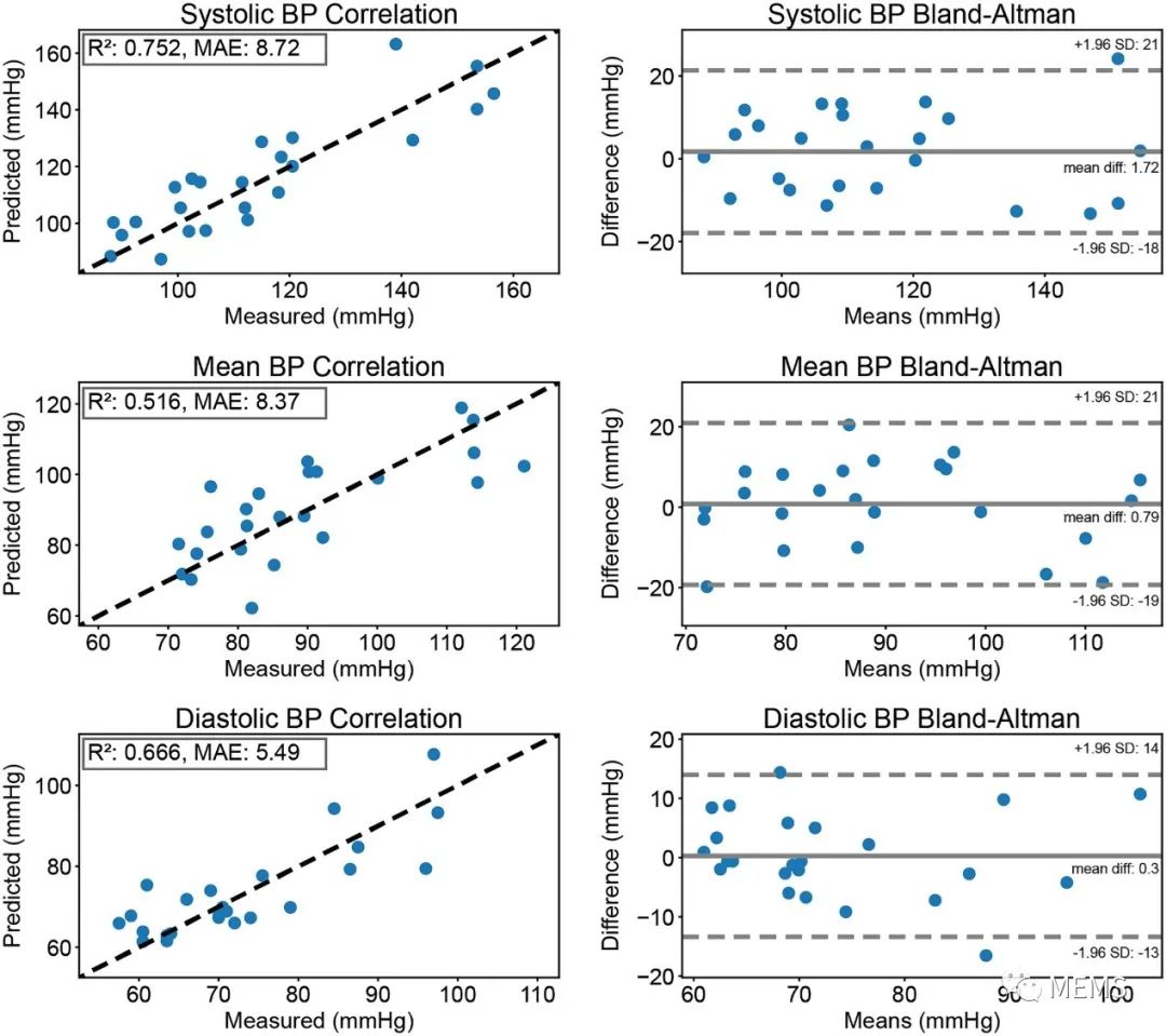 无需校准即可测量血压的超低成本智能手机附件BPClip-电子工程专辑