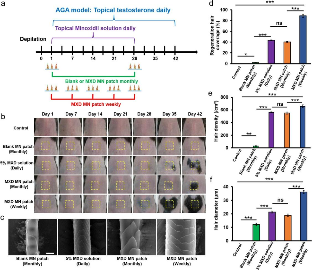 缓释微针贴片用于脱发长效治疗-电子工程专辑