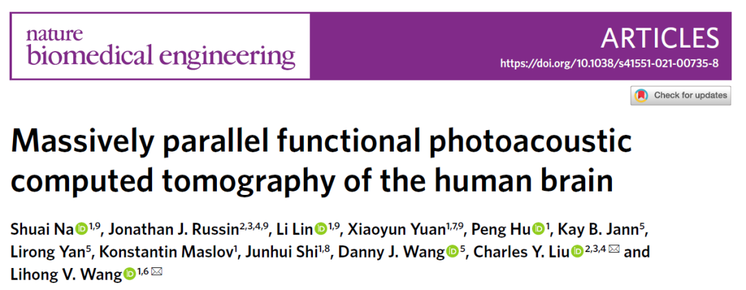 光声成像新突破：人脑功能层析成像-电子工程专辑